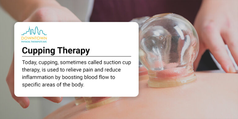 Cupping Therapy NYC | Suction Therapy - Physical Therapists NYC