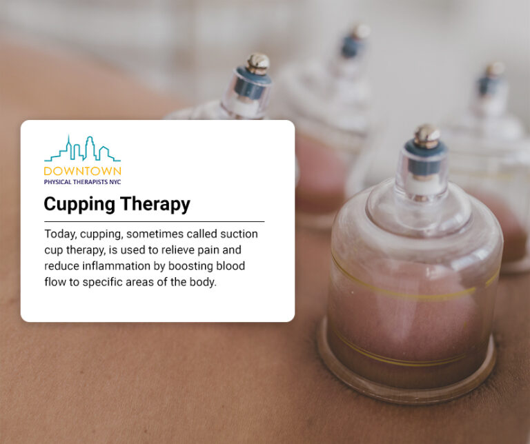 Cupping Therapy NYC | Suction Cup Physical Therapy in New York, NY